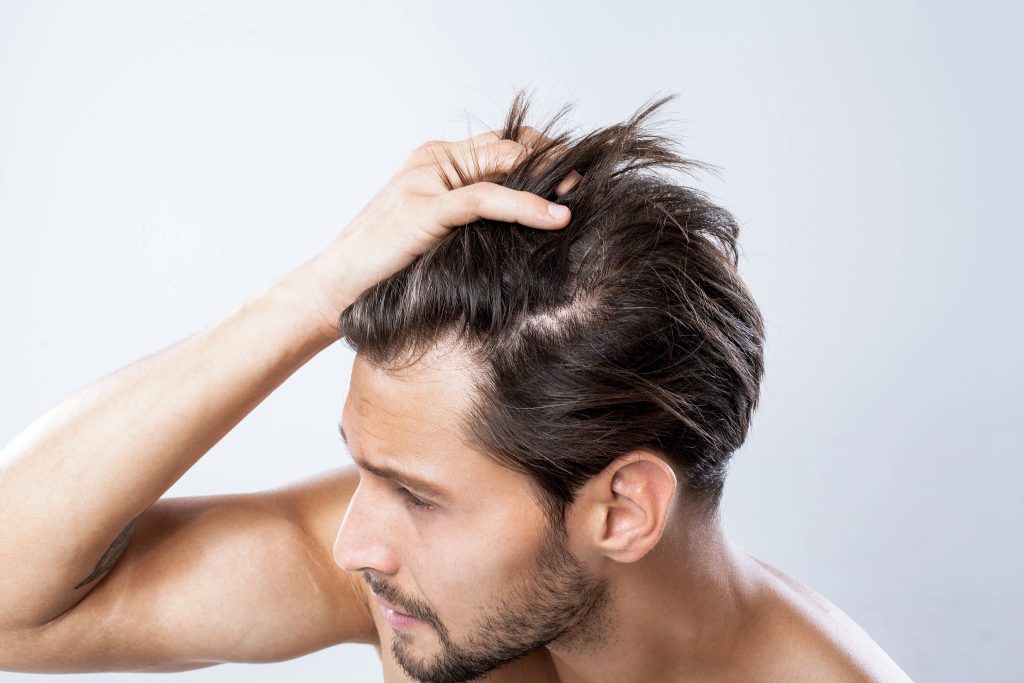 Haarausfall erkennen lernen - TOP HAIR International - Das führende ...